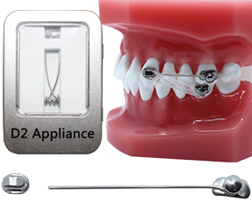 D2 Distalizer Appliance – Low Profile Design | Greiner Orthodontics